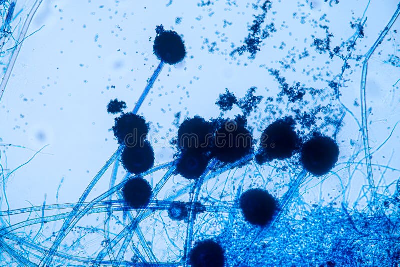 Aspergillus Niger and Aspergillus Oryzae Mold Under Microscope. Stock ...