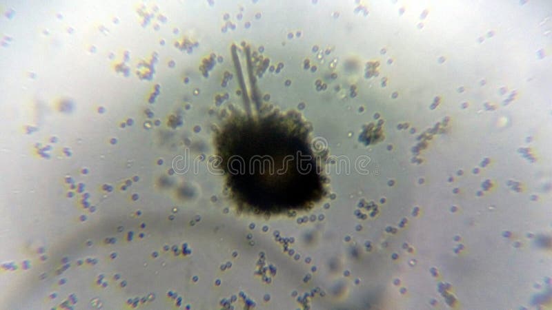 Aspergillus Niger the Black Mold Conidia Under the Microscope Stock ...