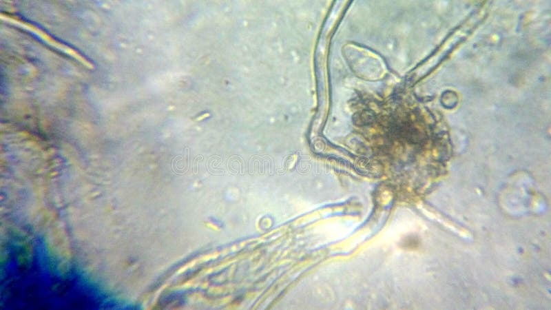 Aspergillus Niger the Black Mold Conidia Under the Microscope Stock ...