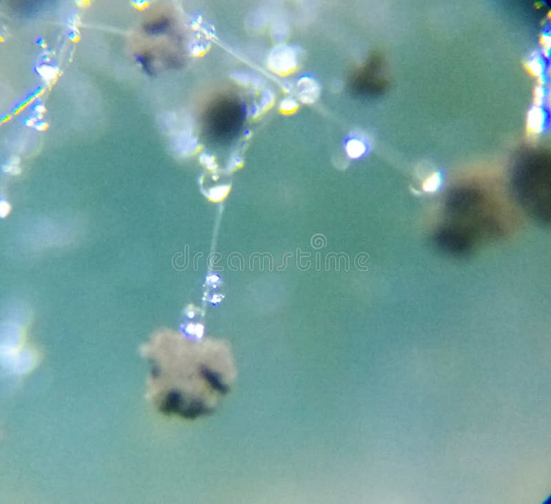Aspergillus Niger the Black Mold Conidia Under the Microscope Stock ...