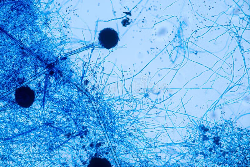 Aspergillus Niger E Aspergillus Oryzae Muffe Sotto Microscopio ...