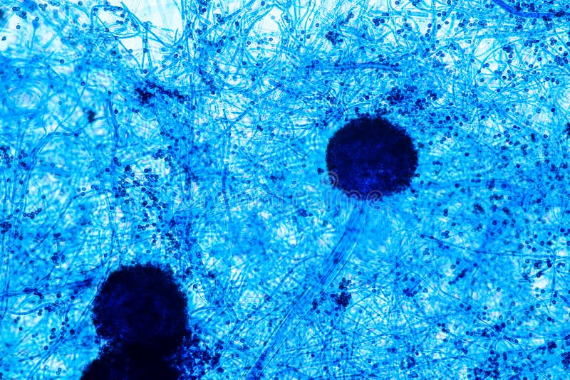 Aspergillus Niger E Aspergillus Oryzae Muffe Sotto Microscopio ...