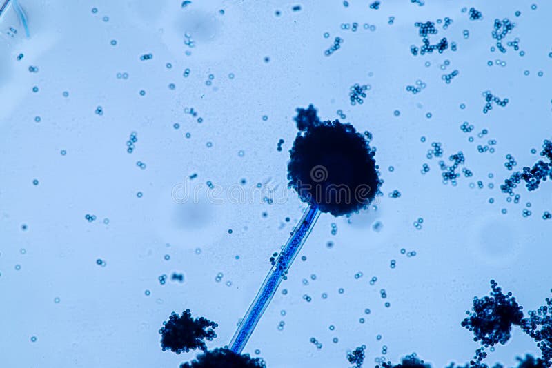 Aspergillus Niger E Aspergillus Oryzae Muffe Sotto Microscopio ...