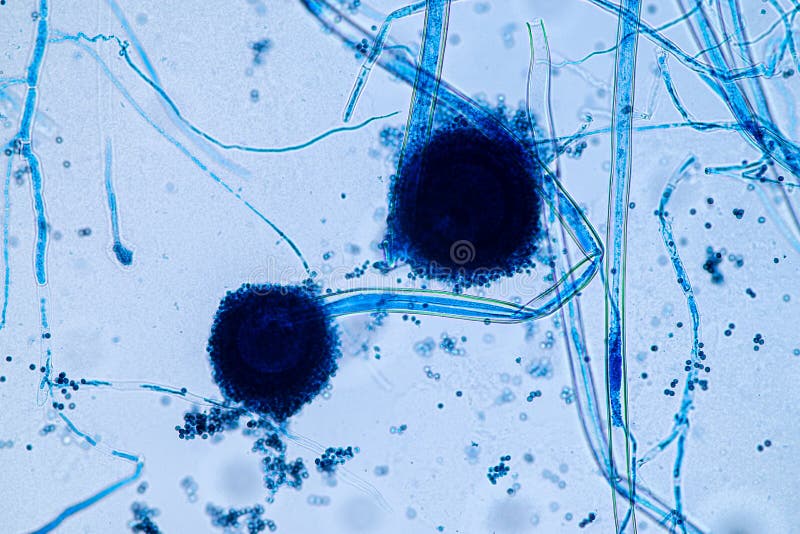 Aspergillus Niger E Aspergillus Oryzae Muffe Sotto Microscopio ...