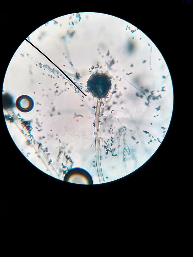 Aspergillus Sp. in Microscope Stock Illustration - Illustration of ...