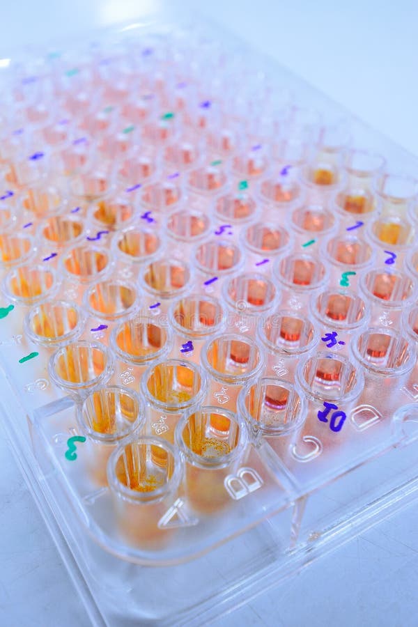 Assay Plate 96 Well with Orange Buffer Stock Image - Image of analyzing ...