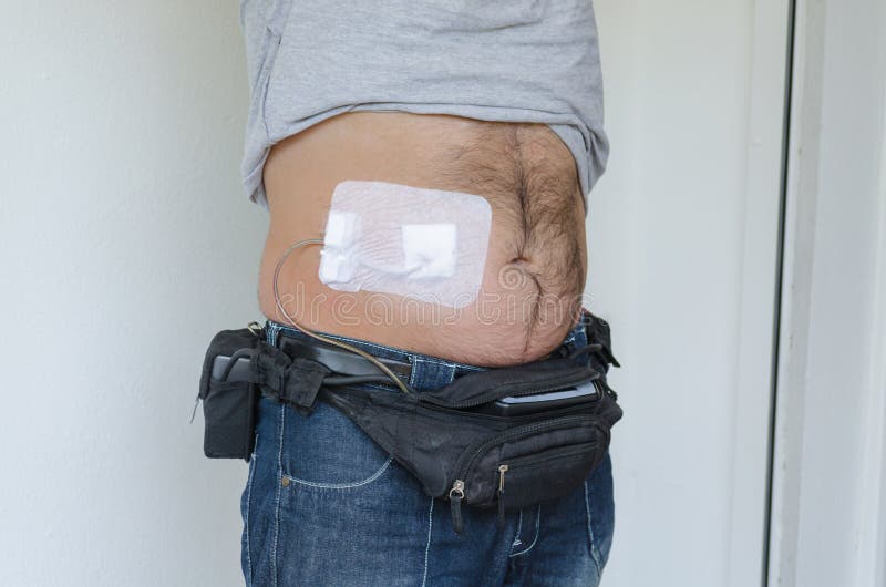 Battery Anatomy Photos - Free & Royalty-Free Stock Photos from Dreamstime