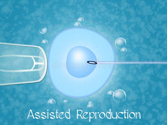 Assisted reproduction stock illustration. Illustration of fertility ...