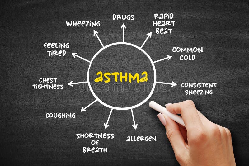 Asthma Mind Map Process on Blackboard, Medical Concept for ...