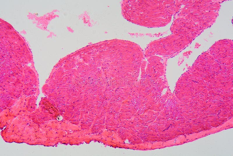Atrial Wall of a Human Heart in the Microscope Stock Image - Image of ...