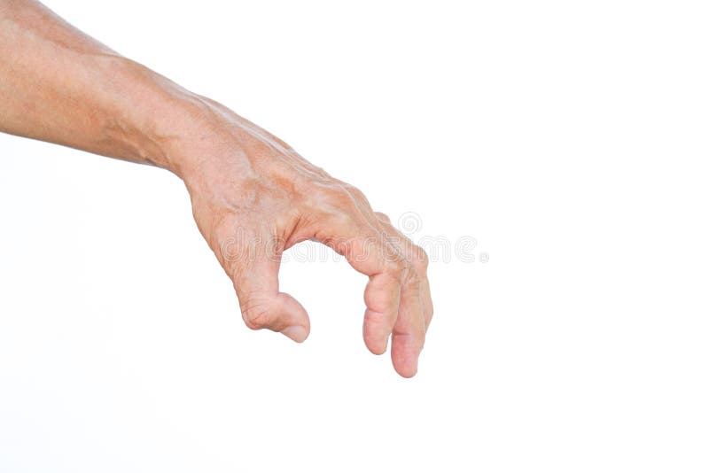 Atrophie Musculaire De La Main Gauche Entre Le Pouce Et Lindex Image