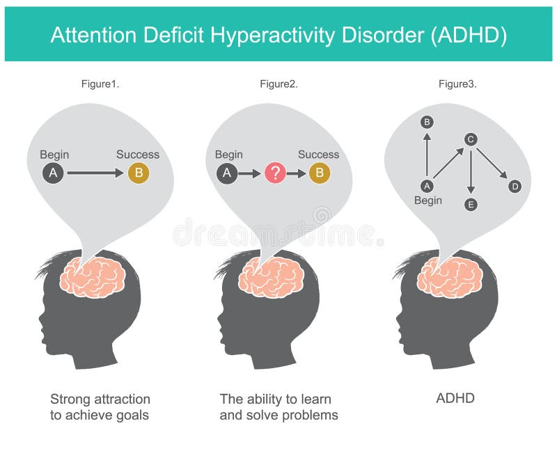 Attention Deficit Hyperactivity Disorder Symbol Conceptual Design Stock ...