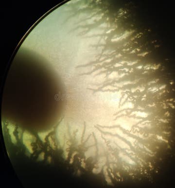 Microscope View of a Aureobasidium Pullulans Fungalcolony Stock Image ...