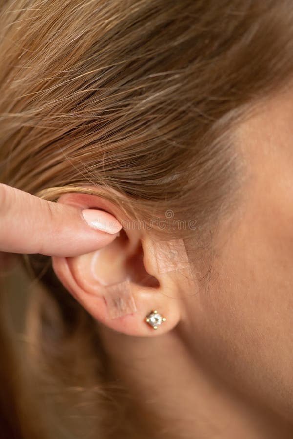 Auriculotherapy Stimulates Pressure Points on the Ear Stock Photo ...