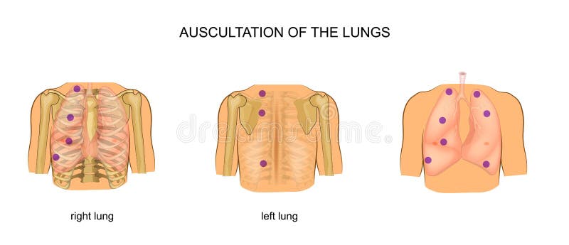 Lungs Auscultation Vector Illustration. Stock Vector - Illustration of ...