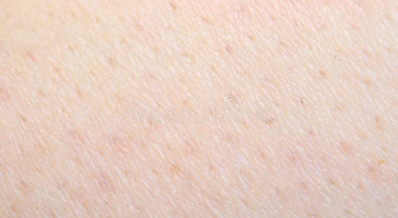 Ausführliche Haut stockfoto. Bild von dermatologie, kaukasisch - 30725124