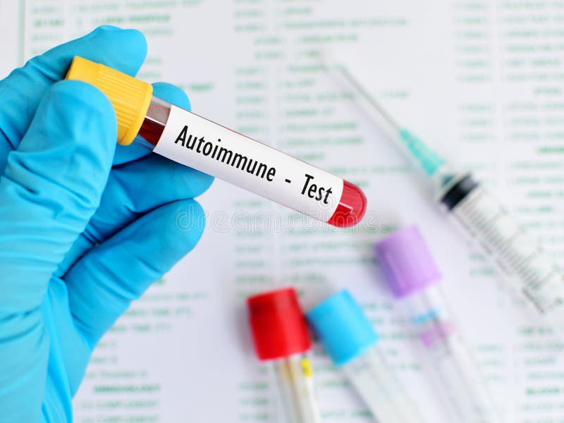 Autoimmune test stock image. Image of disease, technology - 68974589