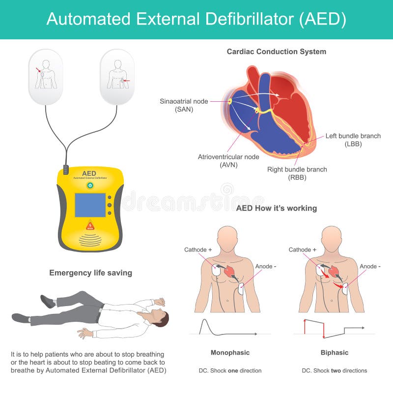 Automated External Defibrillator. Stock Vector - Illustration of life ...