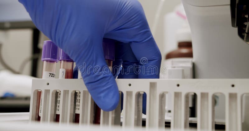 Automated Machine in Work Process, Blood and Urine Sampleanalysis ...