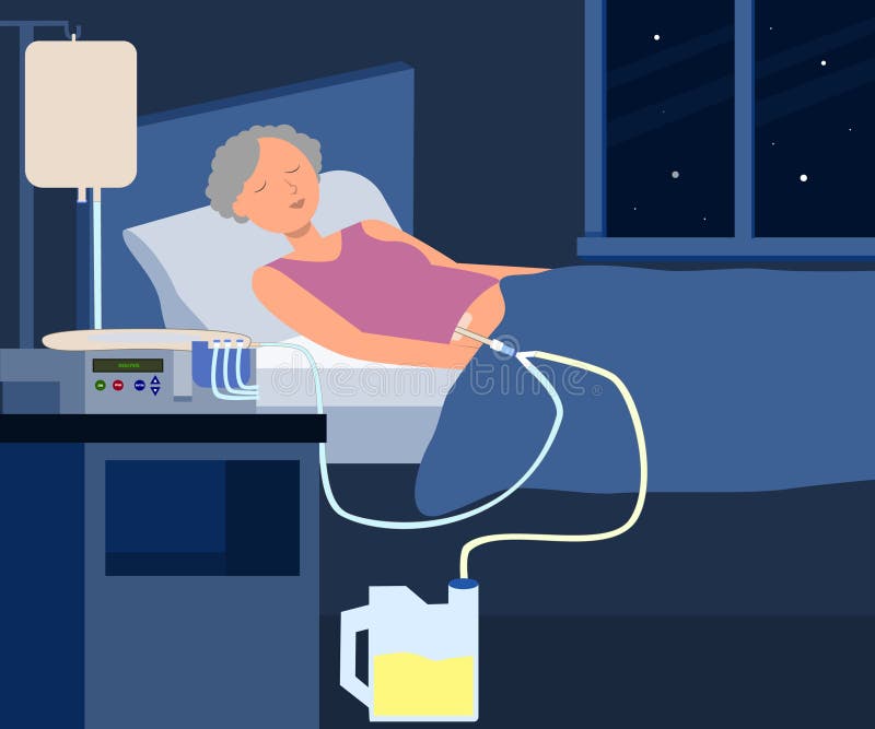 Automated Peritoneal Dialysis at Night. Stock Vector - Illustration of ...