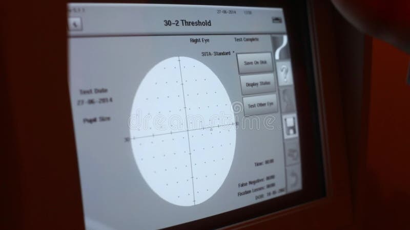 Automatic Computer Perimeter Screen and Hand of Stock Video - Video of ...