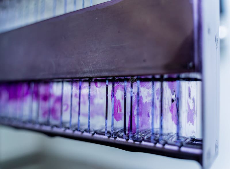 Automatic Multi Slides Stainer at the Modern Laboratory Stock Image ...