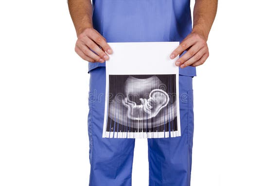 Avortement photo stock. Image du embryon, industrie, suspension - 32314302