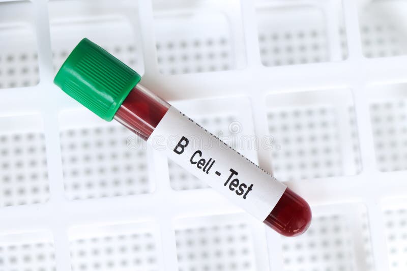 B Cell Test, Blood Sample To Analyze in the Laboratory Stock Image ...