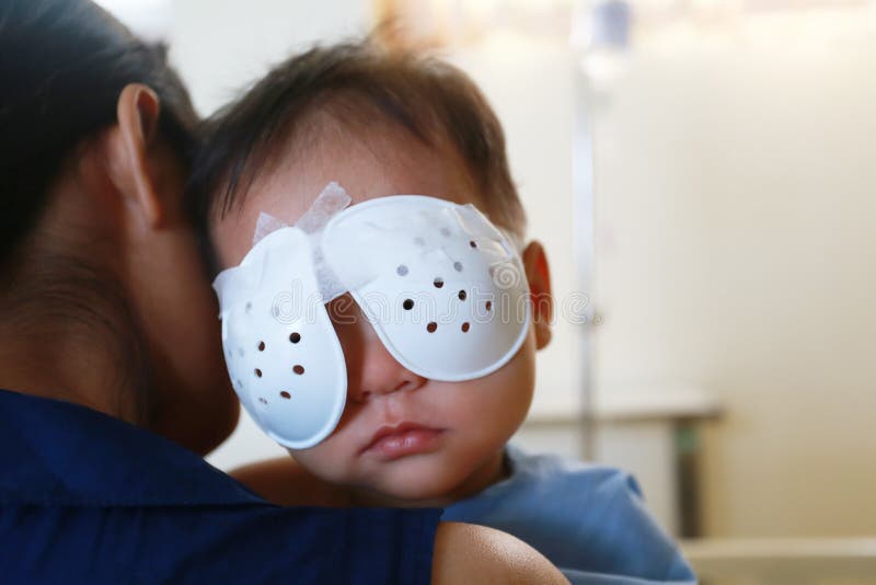 Babies Undergoing Eye Surgery Stock Image - Image of born, emotion ...