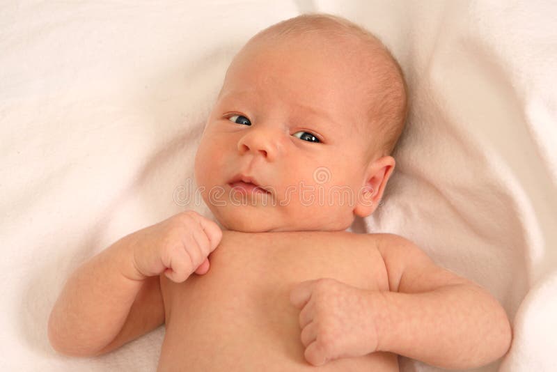 Baby with Allergic Diathesis Stock Image - Image of childhood, facial ...