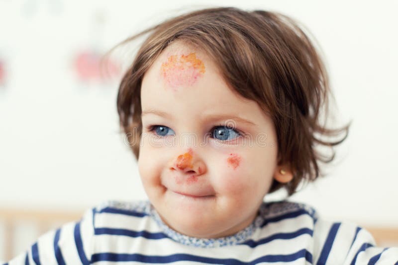 Baby with bruises stock image. Image of trauma, injured - 44372671