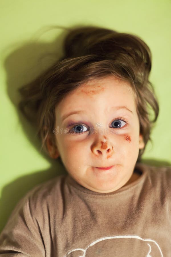 Baby with bruises stock image. Image of making, injury - 44372673