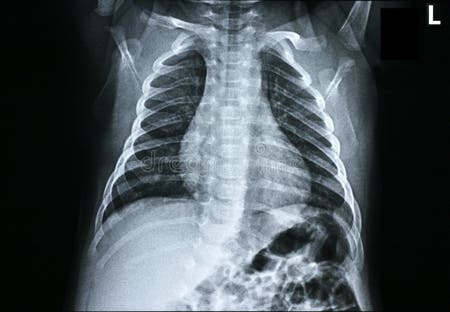 922 Trauma Baby Clipart Stock Photos - Free & Royalty-Free Stock Photos ...