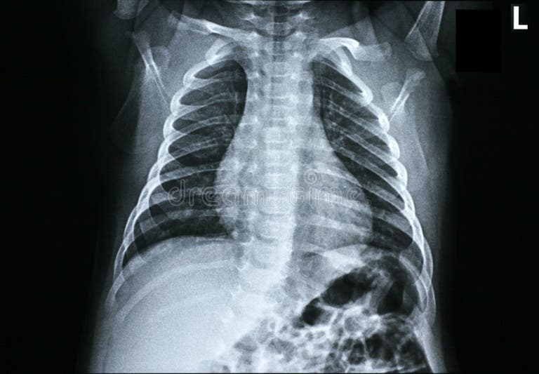 1,066 Parts Chest Stock Photos - Free & Royalty-Free Stock Photos from ...