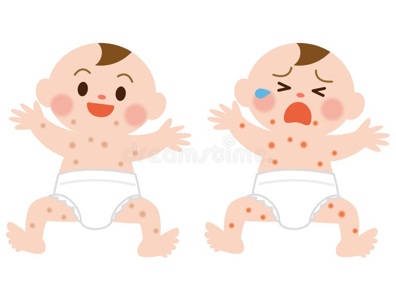 Baby is crying in the rash stock vector. Illustration of cartoon - 78092138