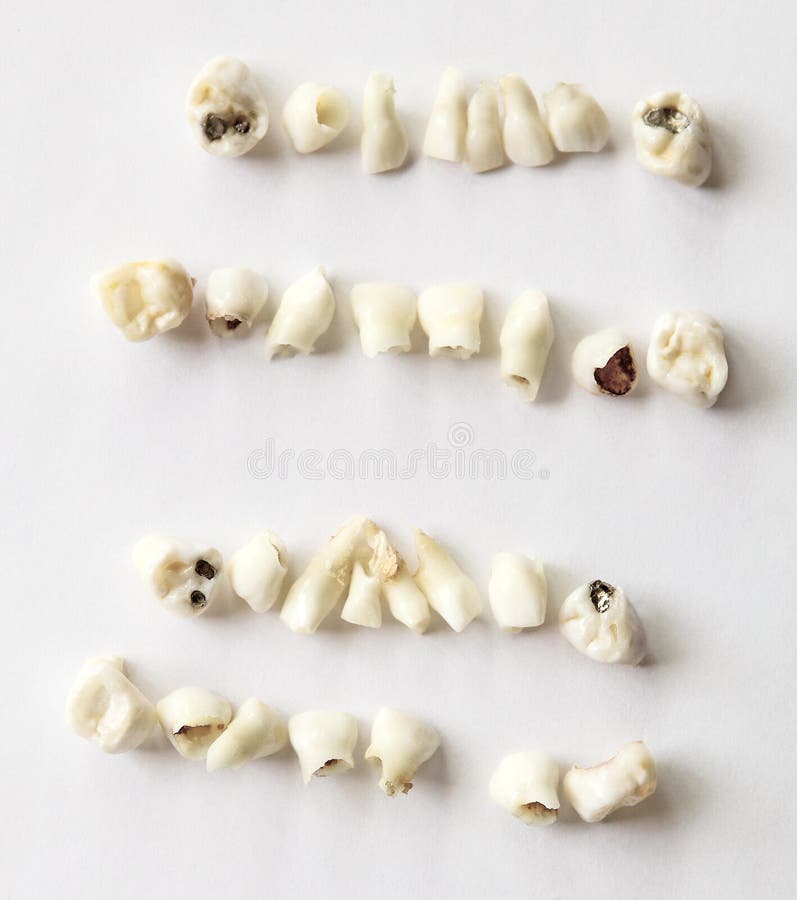 Baby Teeth Stock Image - Image: 12507341
