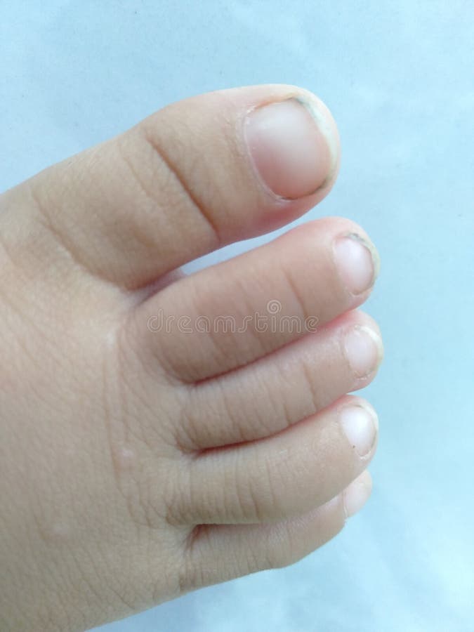 Baby Toes with Long Dirty Nails Stock Photo - Image of pink, skin ...