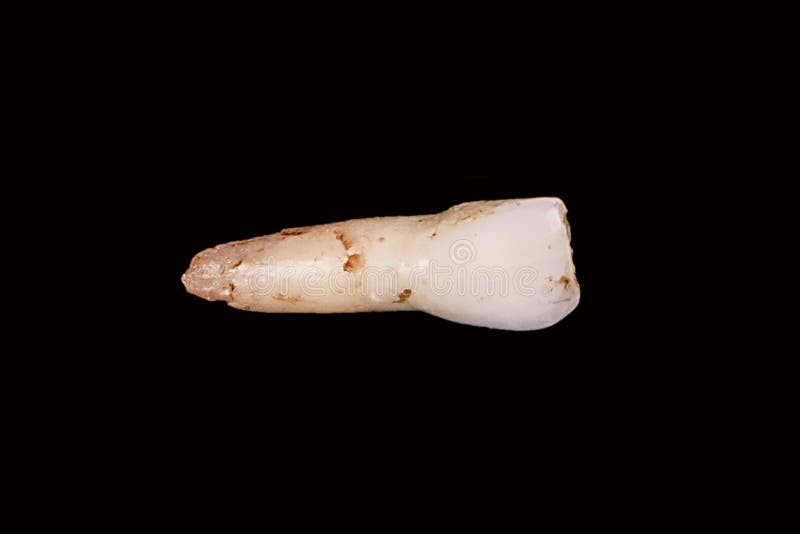 Baby Tooth with Root, Isolated Stock Photo - Image of wellness, health ...