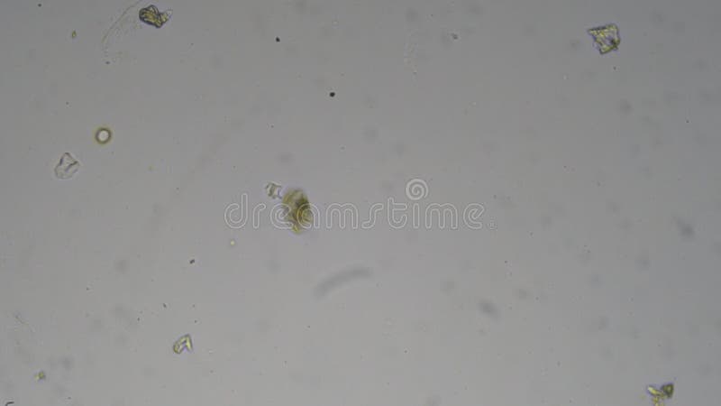 Baby of Triops Under a Microscope. Stock Footage - Video of natural ...