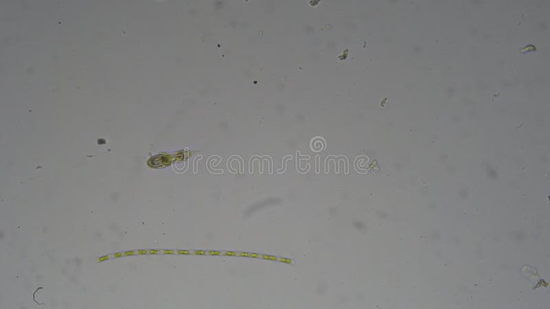 Baby of Triops Under a Microscope. Stock Footage - Video of natural ...