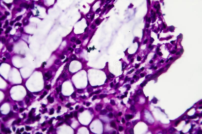 Bacillary Dysentery, Light Micrograph Stock Image - Image of bacillary ...