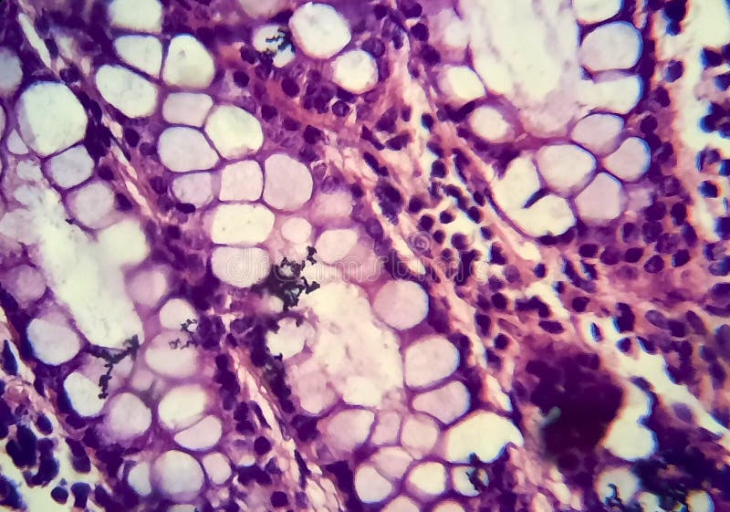 Bacillary Dysentery, Light Micrograph Stock Photo - Image of ...