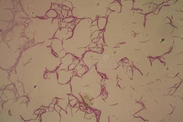 Bacillus Anthracis Anthrax 200x Stock Photo - Image of milzbrand ...