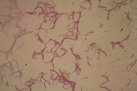 Bacillus Anthracis Anthrax 200x Stock Photo - Image of milzbrand ...