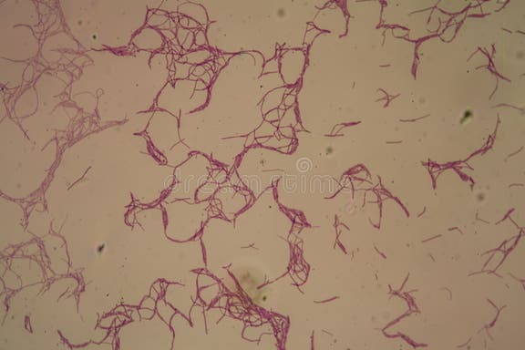 Bacillus Anthracis Anthrax 200x Stock Photo - Image of milzbrand ...