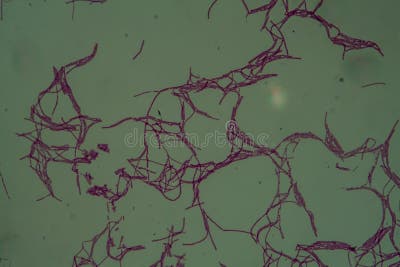 Bacillus Anthracis Anthrax 200x Stock Image - Image of bacillus, germs ...
