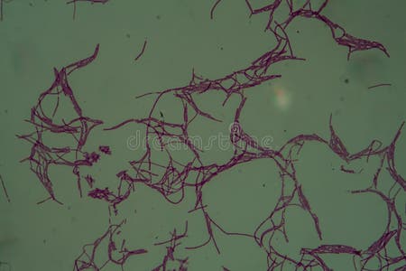 Bacillus Anthracis Anthrax 200x Stock Image - Image of bacillus, germs ...