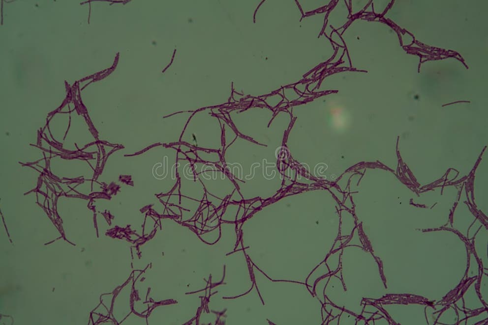 Bacillus Anthracis Anthrax 200x Stock Image - Image of bacillus, germs ...