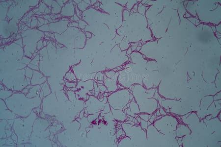 Bacillus Anthracis Anthrax 200x Stock Photo - Image of dangerous ...