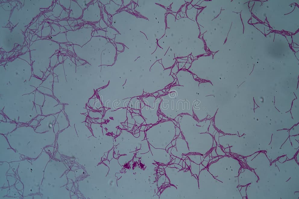 Bacillus Anthracis Anthrax 200x Stock Photo - Image of dangerous ...